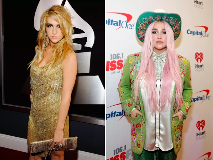 Amerikalı şarkıcı Kesha'ya Ne Oldu? Kesha Nerede? - Onedio