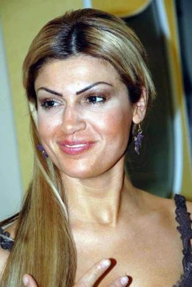 Yok Artık, Biz Şok! Popstar Mehtap'ın İnanılmaz Değişimini Görünce ...