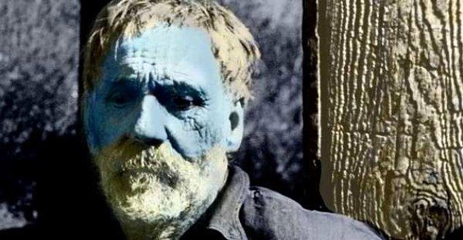 Mavi tenli Fugate ailesi - Onedio