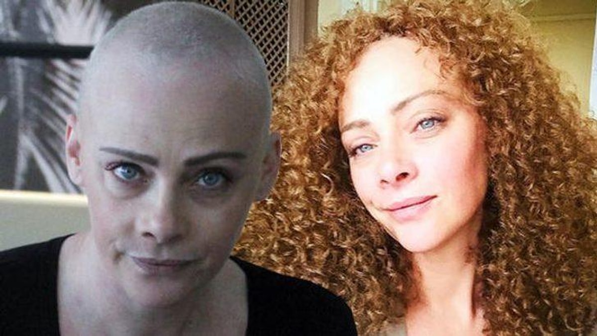 Dilek Serbest Kimdir? Dilek Serbest Kaç Yaşında? - Onedio