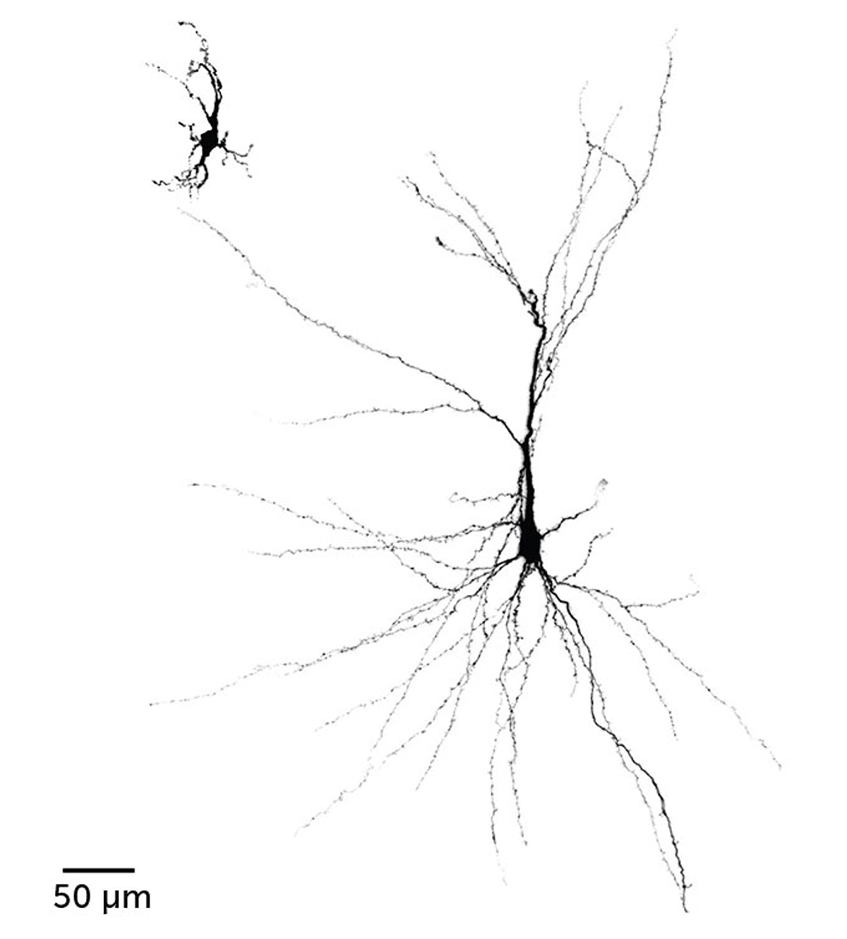 Human Neurons Successfully Transplanted Into Rat Brains, A Major ...