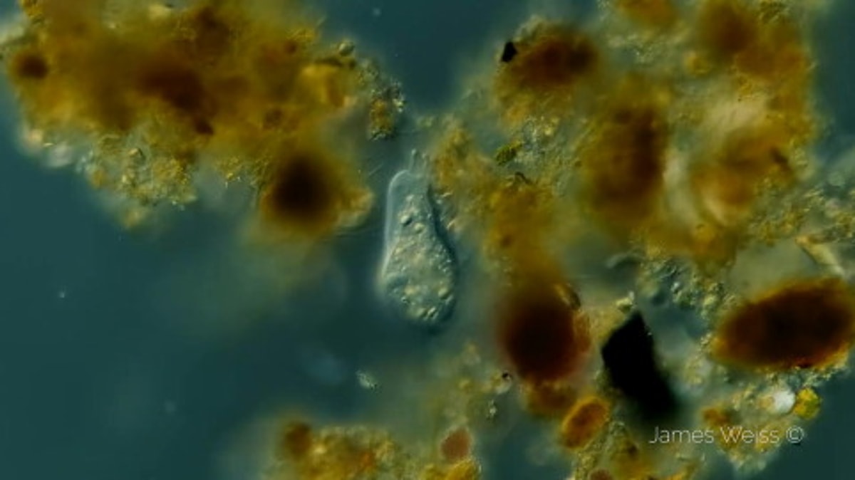 Discovery Of Rare Microbe Species Expands Tree Of Life - Onedio