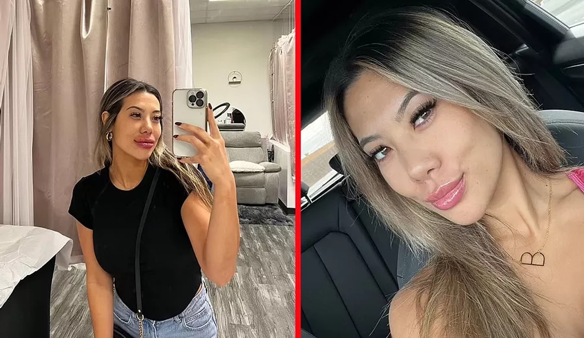 Estetik Mağduru Olan Kadının Yaşadıkları - Onedio