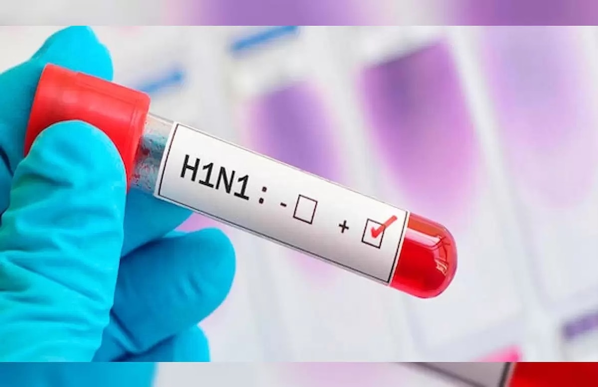 Domuz Gribi Nedir, Belirtileri Nelerdir? - Onedio