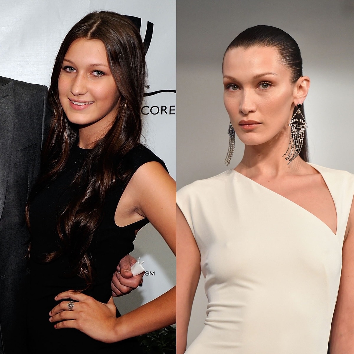 Son Dönemlerde Adını Sık Sık Duyduğumuz 'Barbie Vajina' Estetik ...