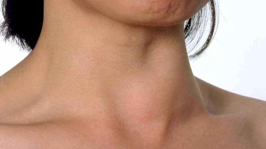 Guatr Nedir? - Onedio