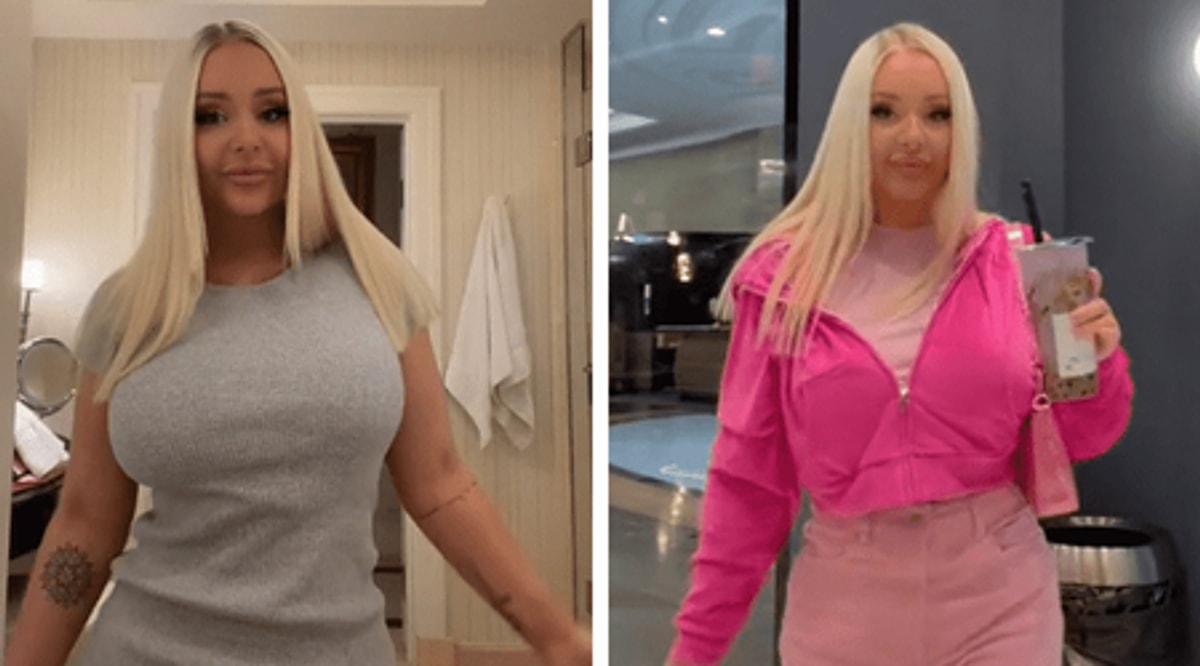 Barbie'ye Benzemek İçin Estetik Oldu - Onedio