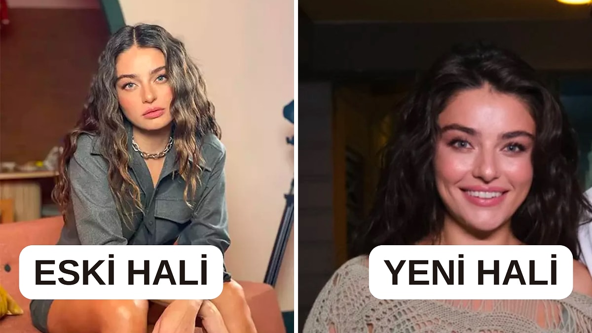 Ayça Ayşin Turan, Değişimiyle Görenleri Şaşırttı! Güzel Oyuncu ...