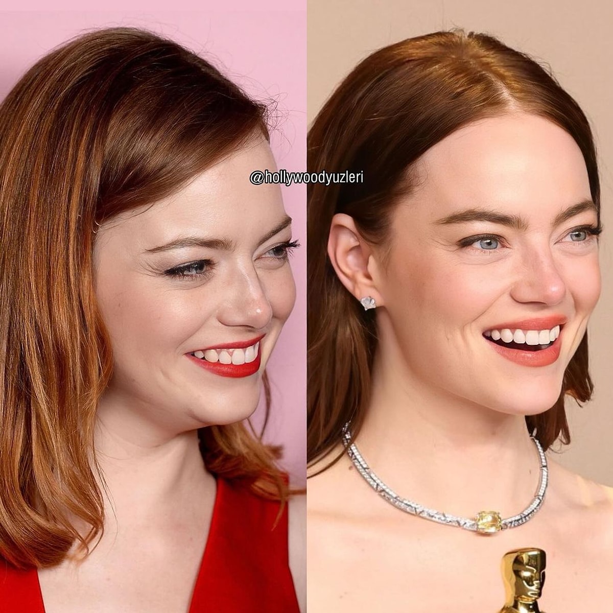 Bir Yıldız Kolay Yetişmiyor: Güzelliğiyle Büyüleyen Emma Stone'un ...