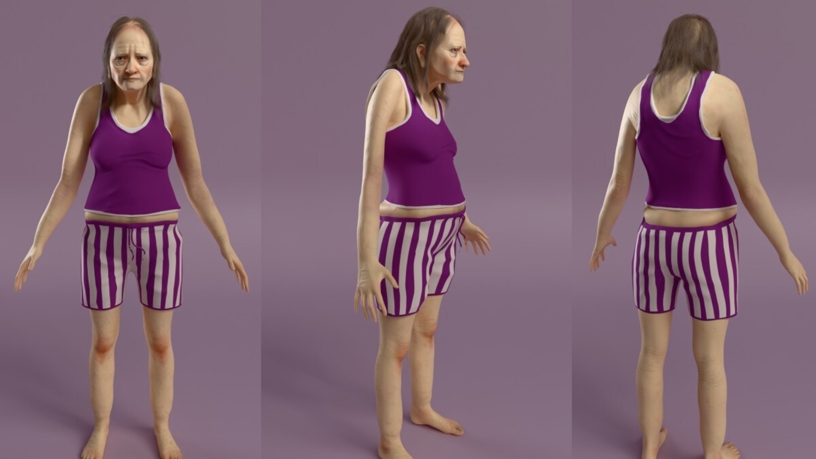 What Happens to Your Appearance When You Sleep Less Than 7 Hours? - Onedio
