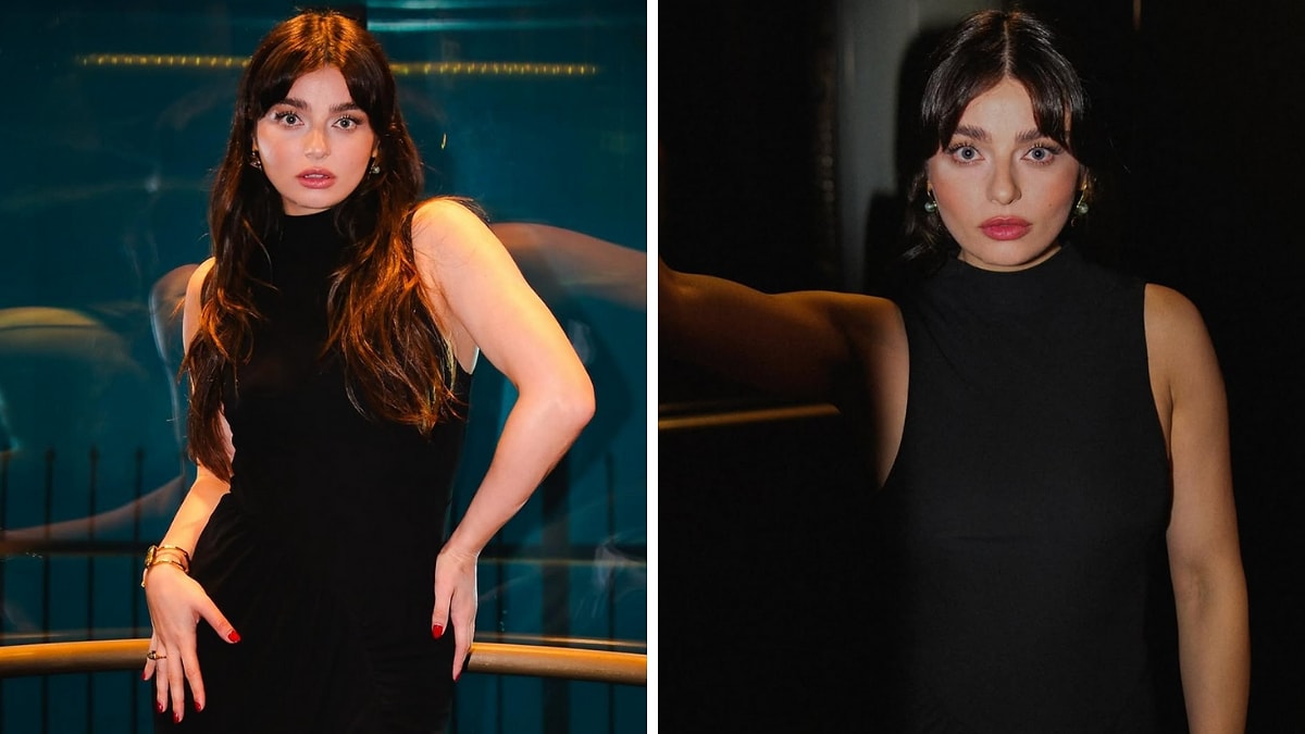 Ayça Ayşin Turan Pozları Botoks İddialarına Neden Oldu! - Onedio