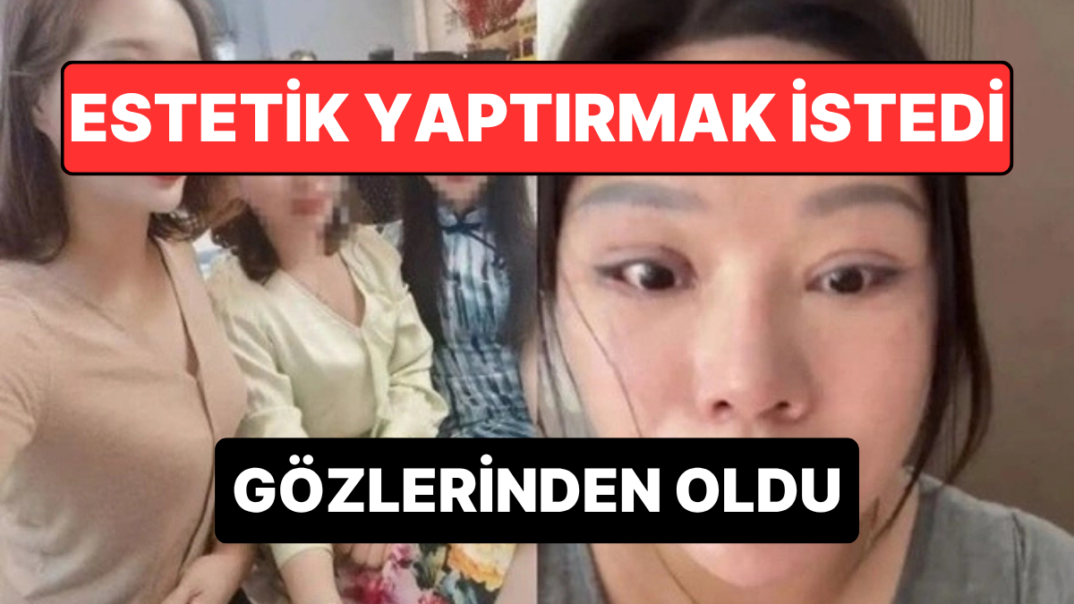 Estetik Olmak İstedi, Gözlerinden Oldu! - Onedio